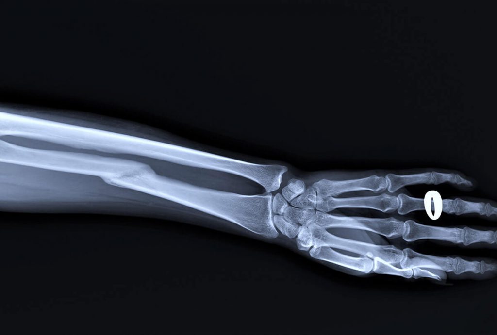 Chirurgia ręki - operacje chirurga ręki | Centrum Medyczne Medicum Warszawa