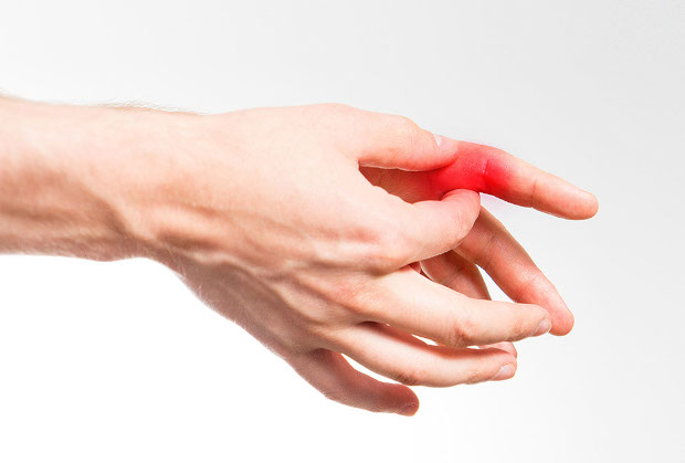 Palec “zatrzaskujący” | Centrum Medyczne Medicum Warszawa